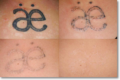 Cosmetic and Laser Surgery | Jacksonville, FL | Precision Dermatology ...